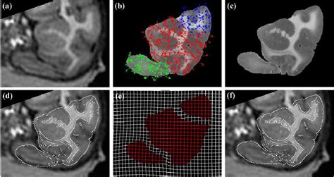 Figure 9 From Automated Piecewise Affine Registration Of Biological Images Semantic Scholar