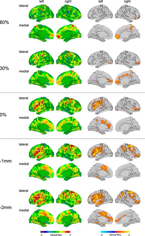 Group‐by‐sex Interaction Effects For Mean Diffusivity Md Regions Download Scientific Diagram