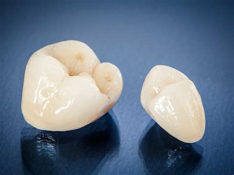 Beautiful Dental Crowns Restore Your Teeth And Your Smile