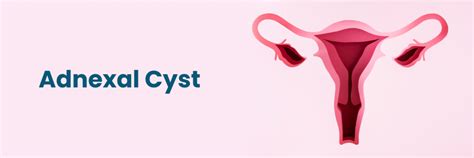 Adnexal Cysts Causes Symptoms And Treatment Options