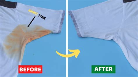 How Do You Remove Armpit Stains At Tracy Macias Blog