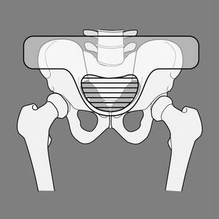 Ideal Positioning Of A Gonad Shield In A Male Patient Download Scientific Diagram