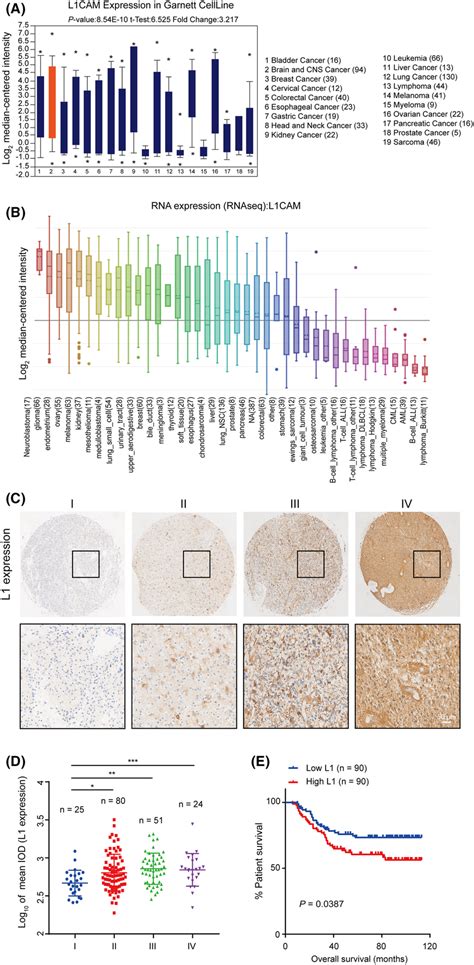 L1 Expression Is Positively Correlated With Malignancy Degree And Download Scientific Diagram