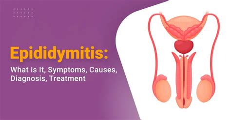 What Is Epididymitis Understanding Its Causes Symptoms And Treatment