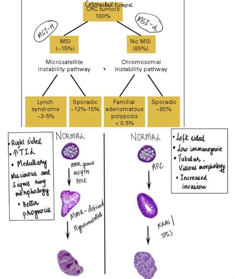 Molecular Pathways Of Colorectal Carcinoma Rpathologymcqs