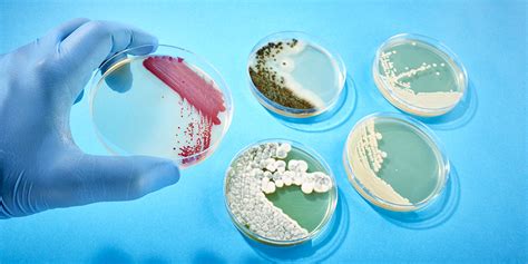 5 Reasons To Avoid Maintaining Stock Cultures In Your Lab Microbiologics Blog