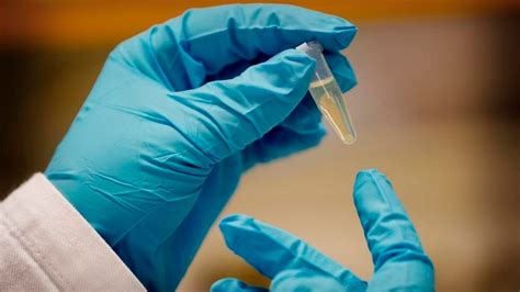 Ai Enhanced Saliva Testing For Early Cancer Detection Archyde