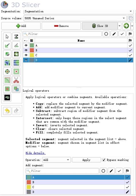 How To Merge Multiple Segments At Once Support 3d Slicer Community
