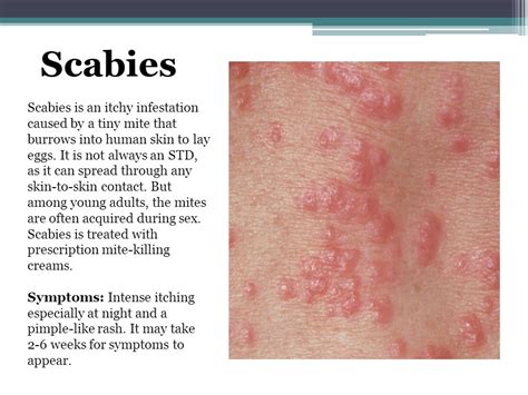 Groin Rash Std