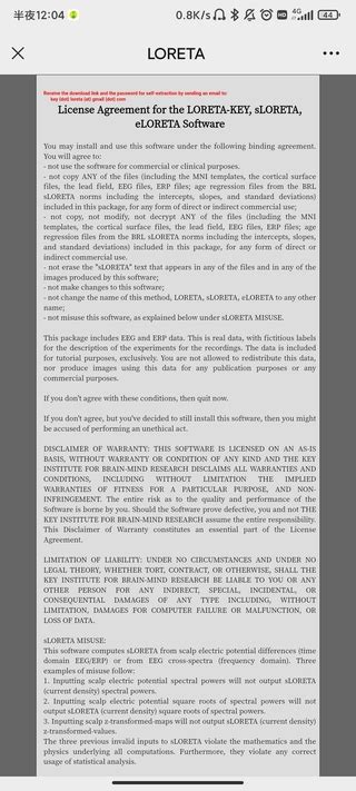 Sloreta如何下载安装呀?编程语言 Csdn问答 Sloreta如何下载安装呀?编程语言 Csdn问答