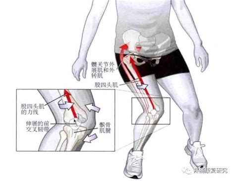 全面讲解膝关节炎肿痛的病因和诊疗分析 MedSci cn