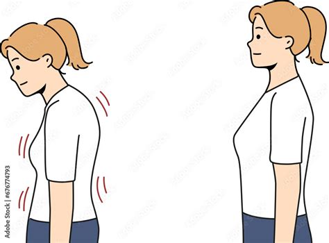 Stooped Woman Before And After Correcting Posture Thanks To Massage Therapist Or Chiropractor
