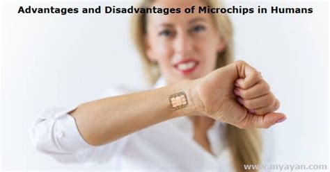 Advantages And Disadvantages Of Microchips In Humans