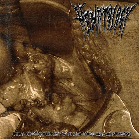 Total Proctocolectomy With Ileal Pouch Anal Anastomosis Hematology