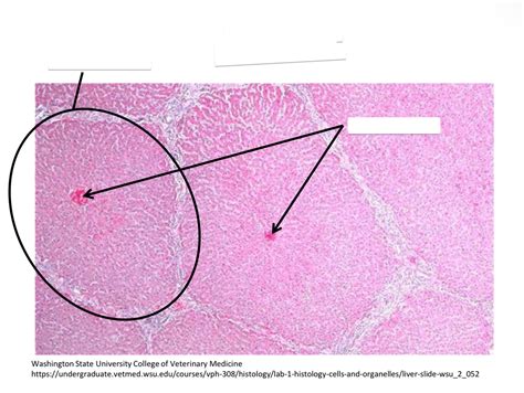 Liver Diagram Quizlet