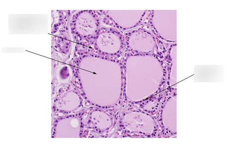 Bio 318 Lab Exam 2 Histology Of The Thyroid Diagram Quizlet