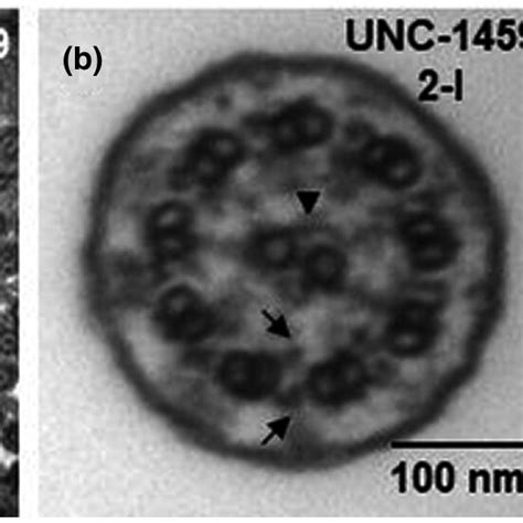 Ciliary Electron Microscopy Images In Pcd Proband A Low Power View