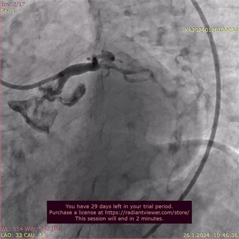 Mladen Tasić On Linkedin Cto Like Lad Lesion Or Straight Short Cto