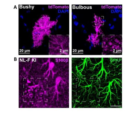 Astrocyte Morphology In Alzheimers Disease Biospective