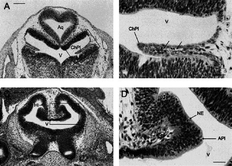 Cerebral Ventricular System And Stage Of Choroid Plexus Development On