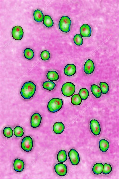 Neisseria Gonorrhoeae Under Microscope Free Picture Photomicrograph