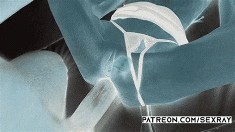 Negative Sex X Ray Gif