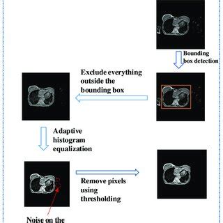 Overview Of The Preprocessing Steps Download Scientific Diagram