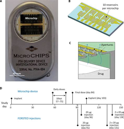 First In Human Testing Of A Wirelessly Controlled Drug Delivery Microchip Science