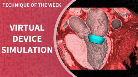 Virtual Device Simulation 3d And Quantitative Imaging Laboratory