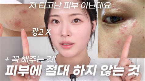 얇고 예민한 수부지 피부⭐️ 피부에 절대 하지 않는것 꼭 해 주는 것 피부가 좋아지기 위해 해주고 있는 노력들 Youtube