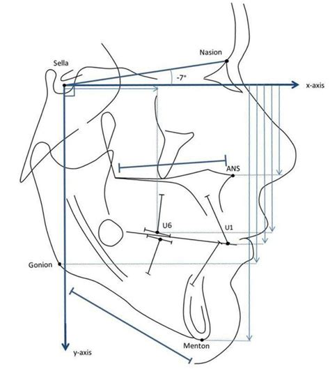 1 Measurements Based On Maxillary Superimposi Download Scientific