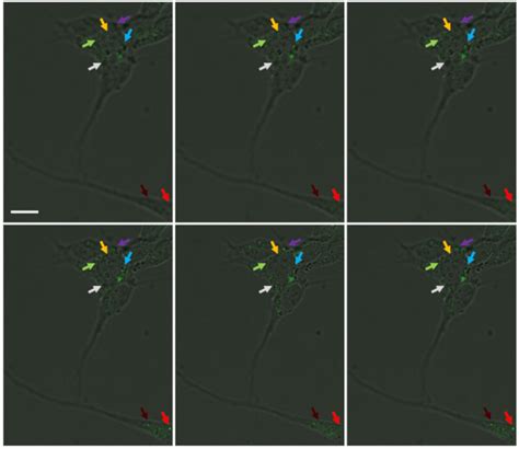 Empowering The Emission Of Upconversion Nanoparticles For Precise