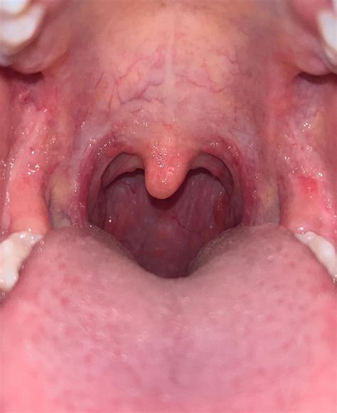 Cobblestone Bumps Album On Imgur