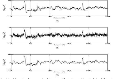 figure 3 from orthogonal features based eeg signal denoising using