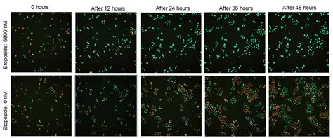 Cell Cycle Analysis Using Cell Cycle Indicator Fucci Yokogawa