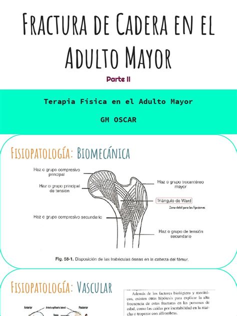 Fractura De Cadera En El Adulto Mayor Parte Ii Enfermedades Y