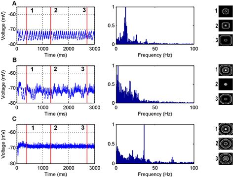Lfp Simulations Over A 3 Second Interval For The Gaba Antagonist Model
