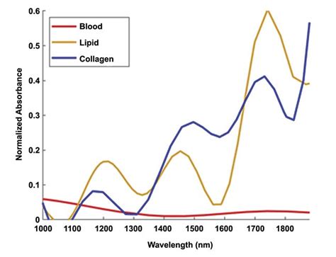 Intravascular Near Infrared Spectroscopy Predicts Heart Attacks