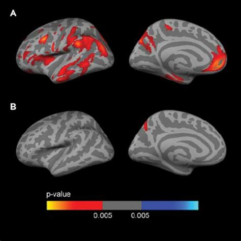 Sex Stratified Fdg Analyses Analysis Between Apoe4 Carriers And Apoe4 Download Scientific