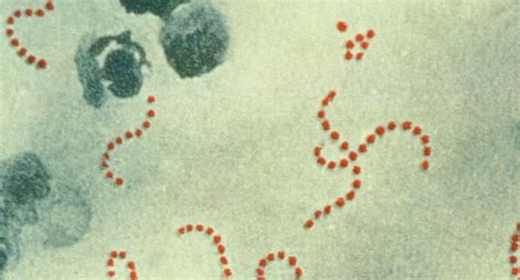 Enfermedad Invasiva Por Streptococcus Pyogenes