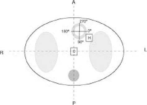 Figure 1 From An Em Algorithm For Estimating Spect Emission And Transmission Parameters From
