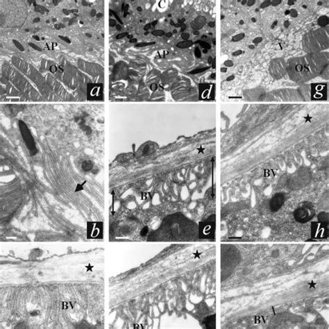 Electron Photomicrographs Of The Basal Rpe Labyrinth And Bruchs Download Scientific Diagram