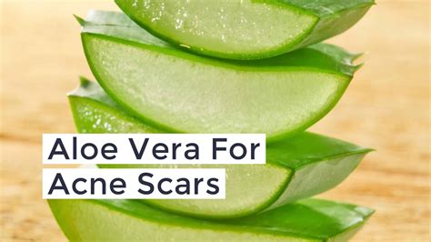 how to clear acne scars using aloe vera