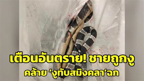 เพจดังเตือน อันตราย หลังชายถูกงูคล้าย ‘งูทับสมิงคลา ฉก ชี้อันตรายเสี่ยงเสียชีวิต