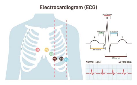 Ecg Vector Art Icons And Graphics For Free Download