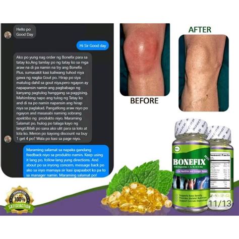 Bonefix Plus Osteoporosis Osteoarthritisgoutrheumatoid Shopee