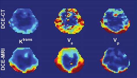 Parametric Maps Estimated By Dce Ct Top Row And The Corresponding Download Scientific Diagram