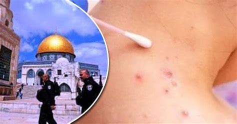 أهم أخبار العرب والعالم حتى الظهيرة الأمم المتحدة تحذر من تدهور الوضع