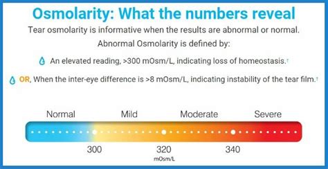 Dry Eye Evaluations Marion In