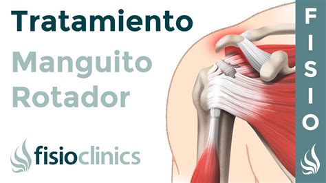 Lesión Del Manguito Rotador Qué Es Diagnóstico Y Tratamiento